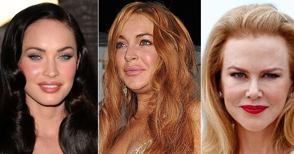 Ces stars ont abusé du Botox